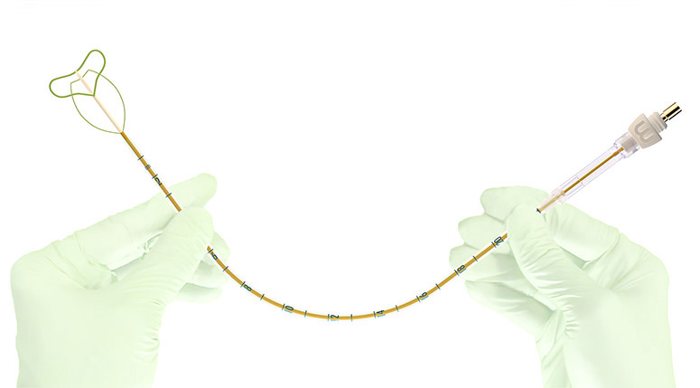 minitouch Outpatient Endometrial Ablation